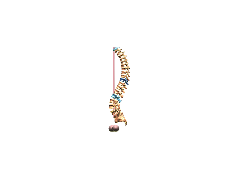 Spine 3D RECONSTRUCTION – Platinum Health Care